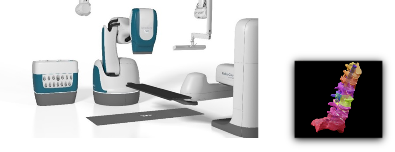 アキュレイ高精度放射線治療装置サイバーナイフシステムとブレインラボ社定位放射線治療計画ソフトウェアBrainlab® Elementsとの連携 ...