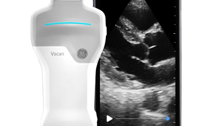 オリンパスが高周波焼灼電源装置「ESG-150」を発売 | MedTech Online | メドテック・オンライン